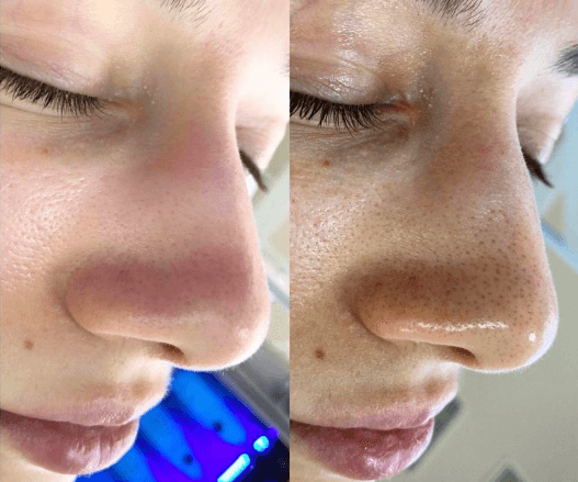 7 Tesla Tabletop Emsculpt Machines for Body Sculpting - DreBodyLaser