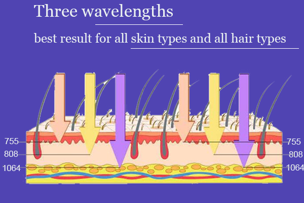 Titanium Prime: Professional Soprano ICE Titanium Alternative